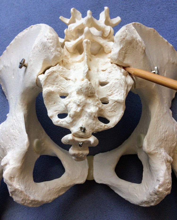 What happens when an SI joint gets stuck? – My Sacroiliac Joint Saga