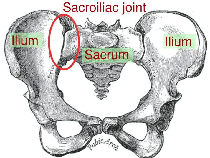 What is an upslip? – My Sacroiliac Joint Saga