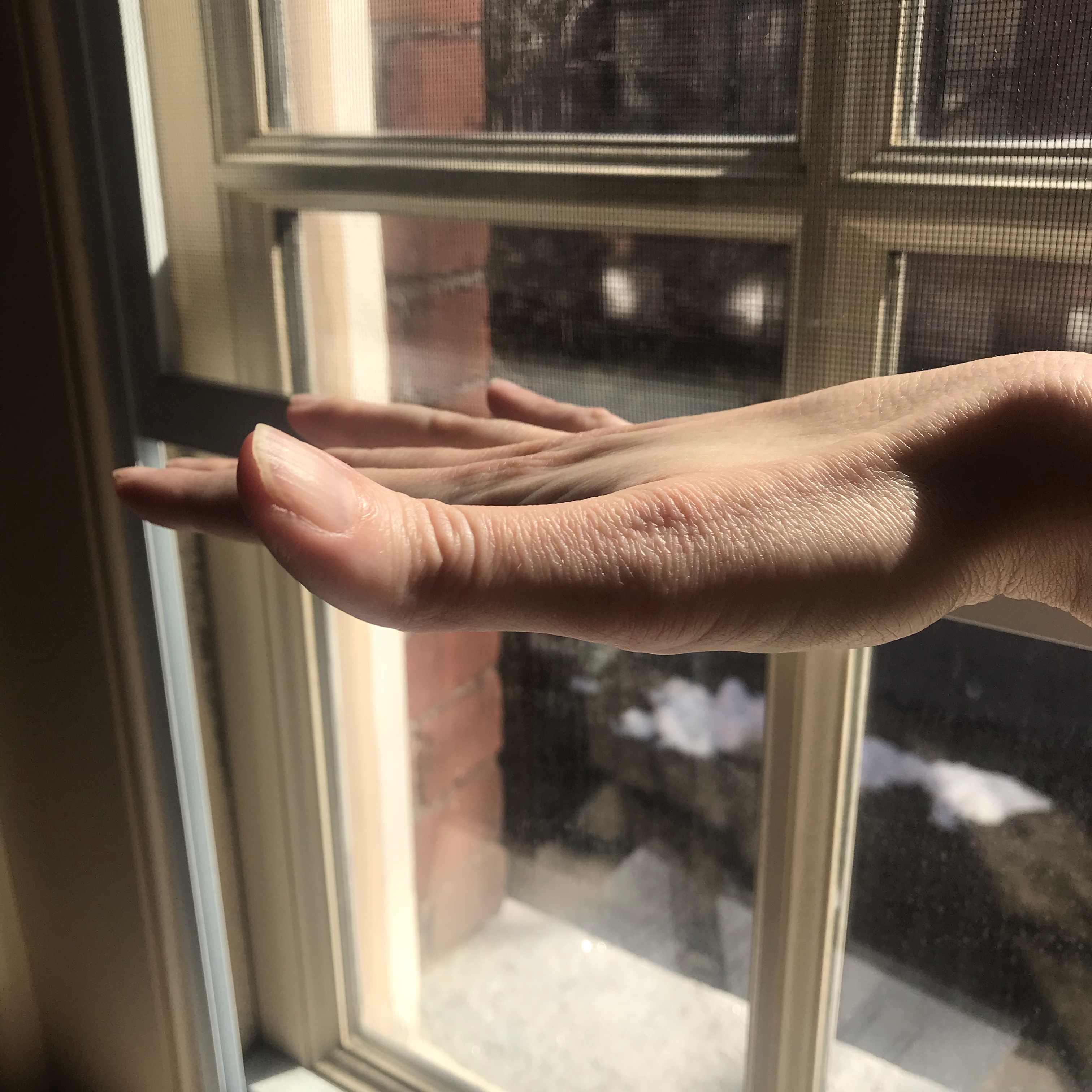 How I got my hypermobility diagnosis, Part 2: The exam – My Sacroiliac ...